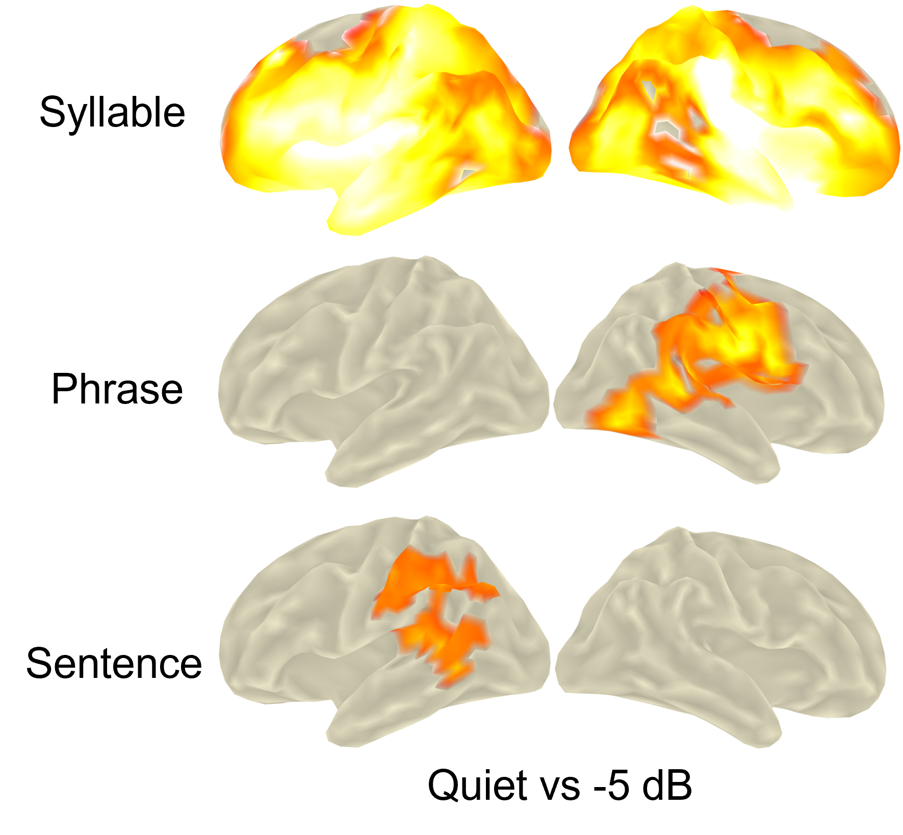 Neural Tracking As A Measure Of Speech Understanding In Noise Nal